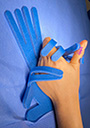 Surgical Finger Traps | Non-Sterile Finger Traps | SW Med-Source